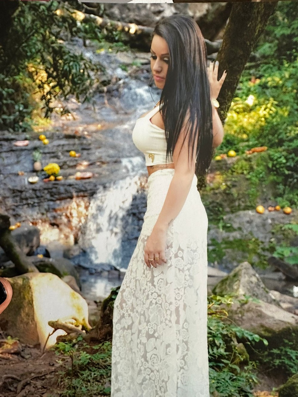 Após gastar R$ 300 mil, influencer encara 16ª cirurgia plástica: 'Sou ...