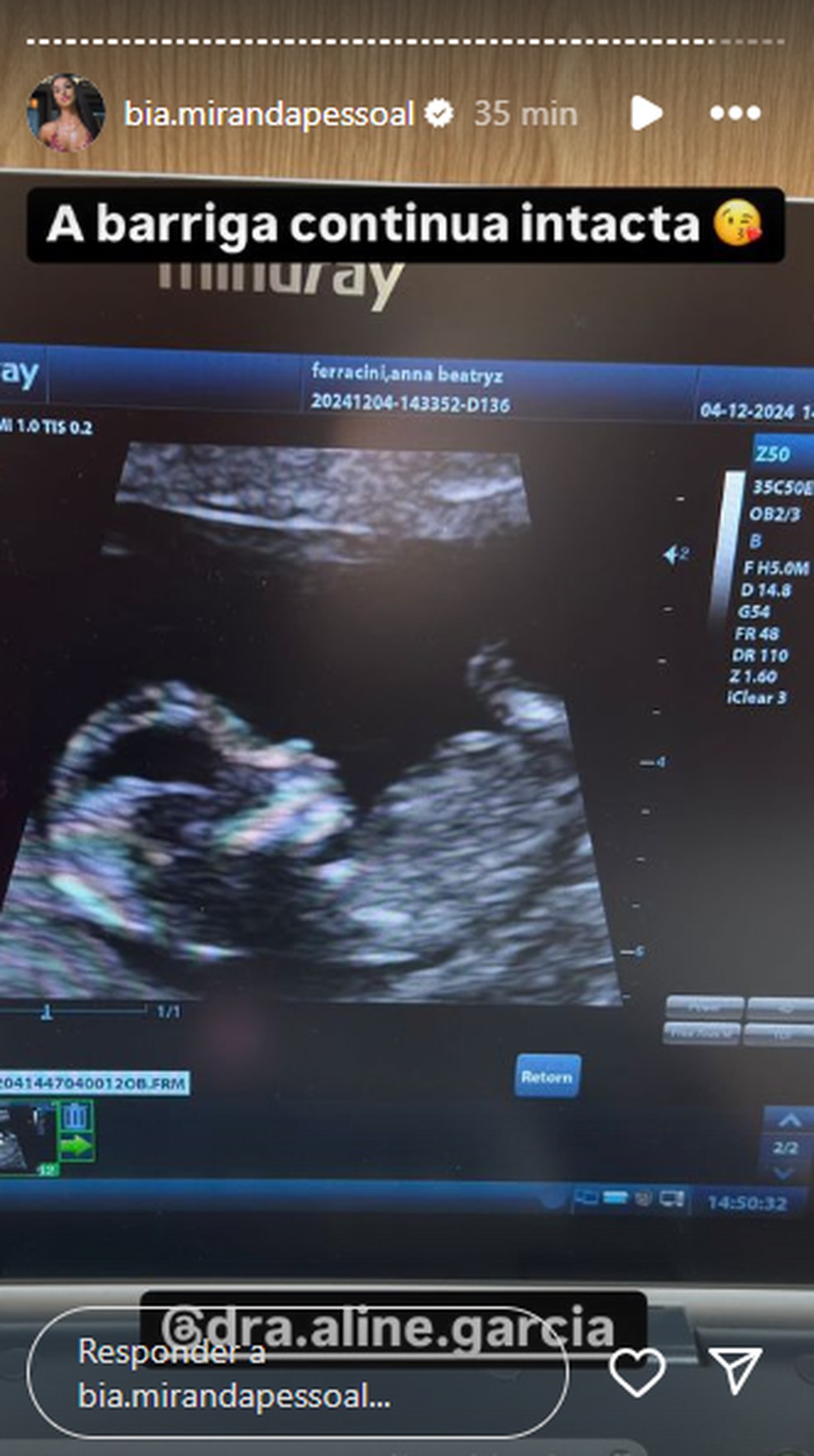 Com barriga chapada, Bia Miranda mostra ultrassom e garante que está ...
