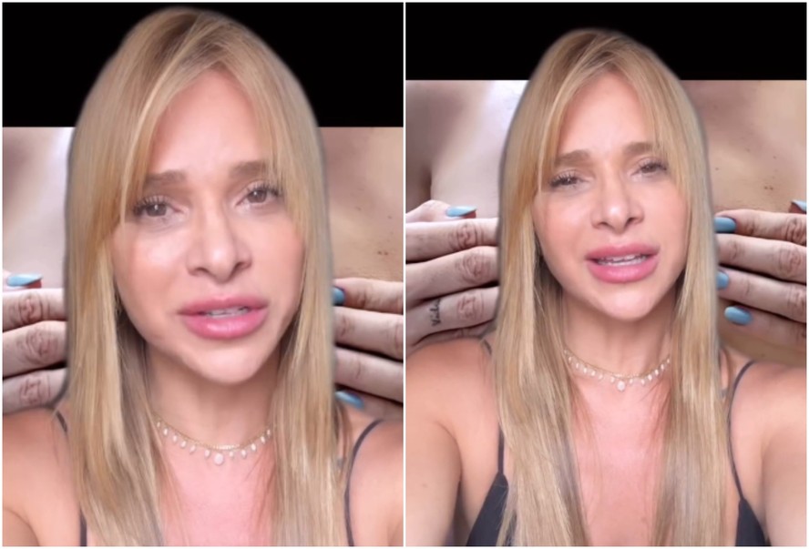 Dany Bananinha faz cirurgia após descobrir 'enormes nódulos': 'Meses de sofrimento'