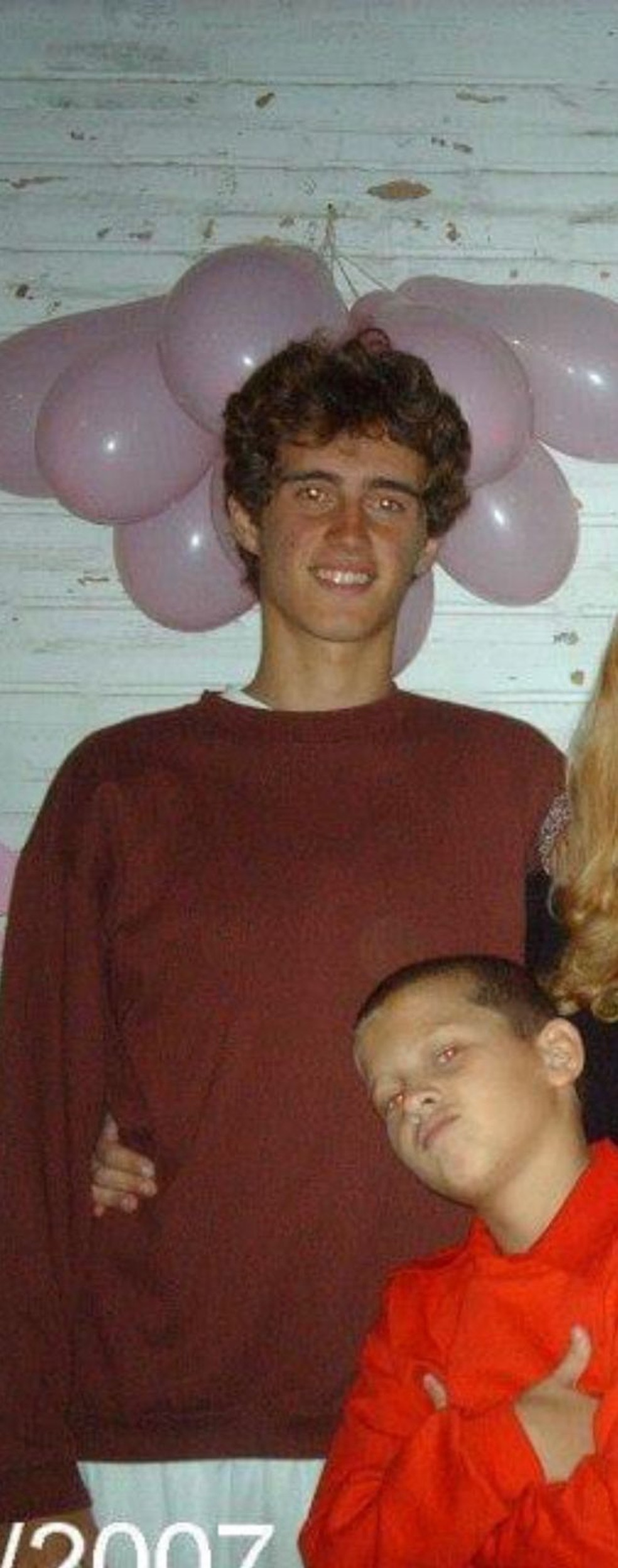 Bombeiro da Eliana diz ter gastado R$ 100 mil em procedimentos; antes e ...