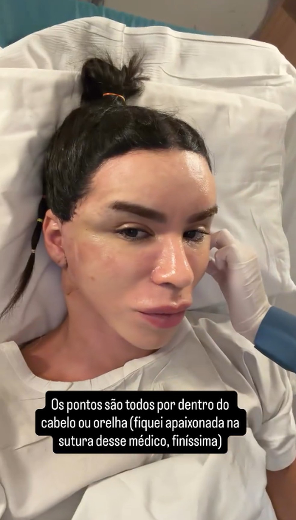 Rafa Uccman se submete a plástica: 'Não queria modificar meu rosto'; veja