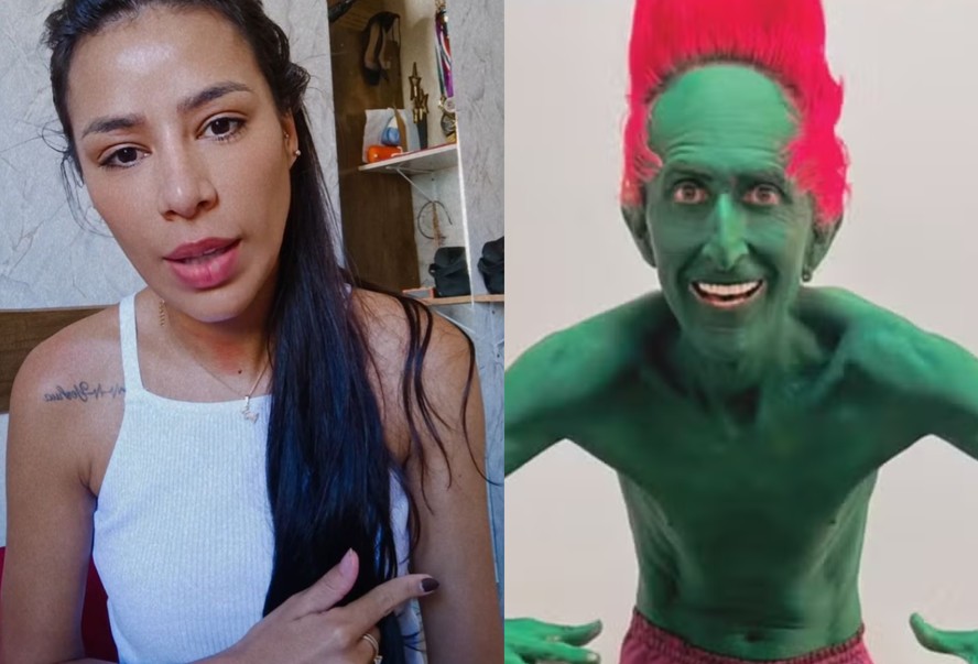 Ex de Hulk Magrelo mostra hematoma ao reafirmar agressão: 'Grudou no ...