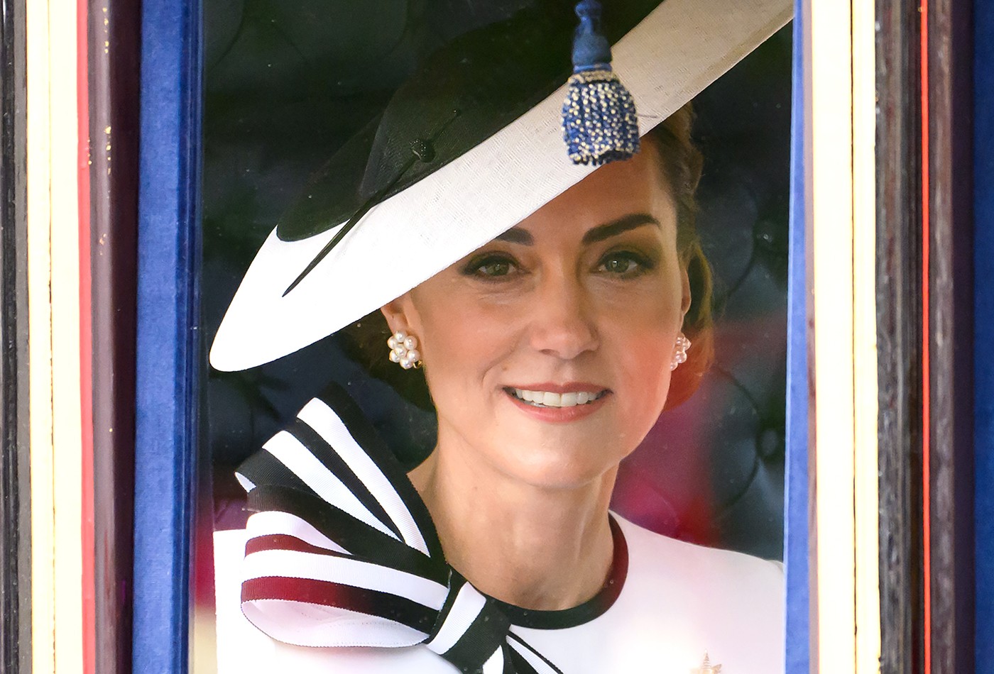 Kate Middleton deve demorar para reaparecer em público, diz ...