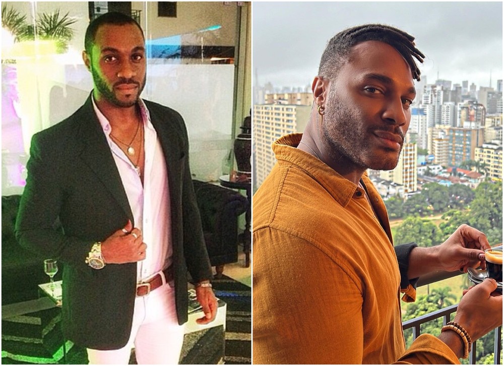 Marido mostra antes e depois do queixo de Fred Nicácio, e manda recado ...