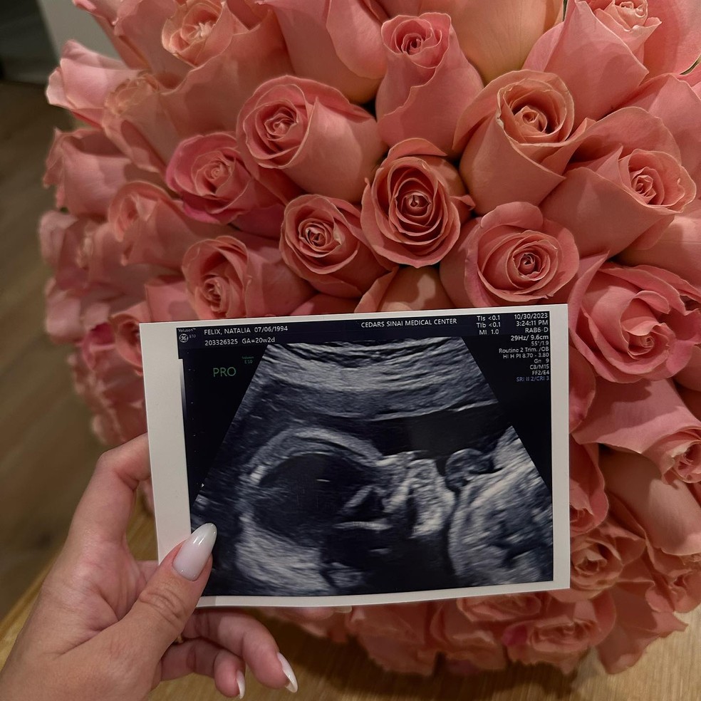 Jogador Douglas Costa e Nathália Felix anunciam que esperam primeiro bebê