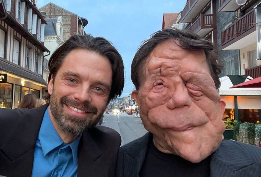 Sebastian Stan defende Adam Pearson após comentário preconceituoso ...