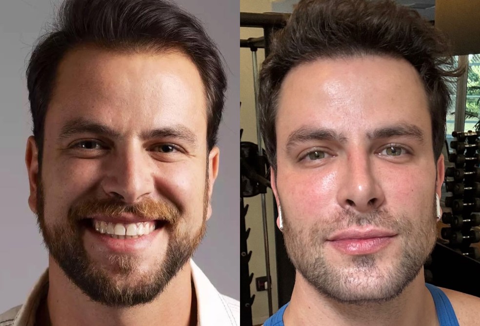 Ex-BBB Gustavo Marsengo surpreende com transformação facial: 'Nem ...