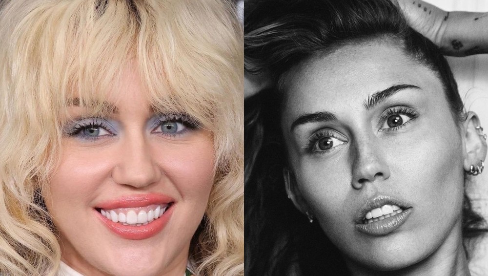 Miley Cyrus é detonada na web após procedimentos estéticos