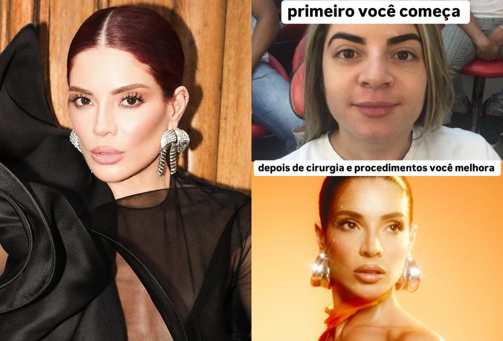 Gkay impressiona com antes e depois de cirurgias e procedimentos ...