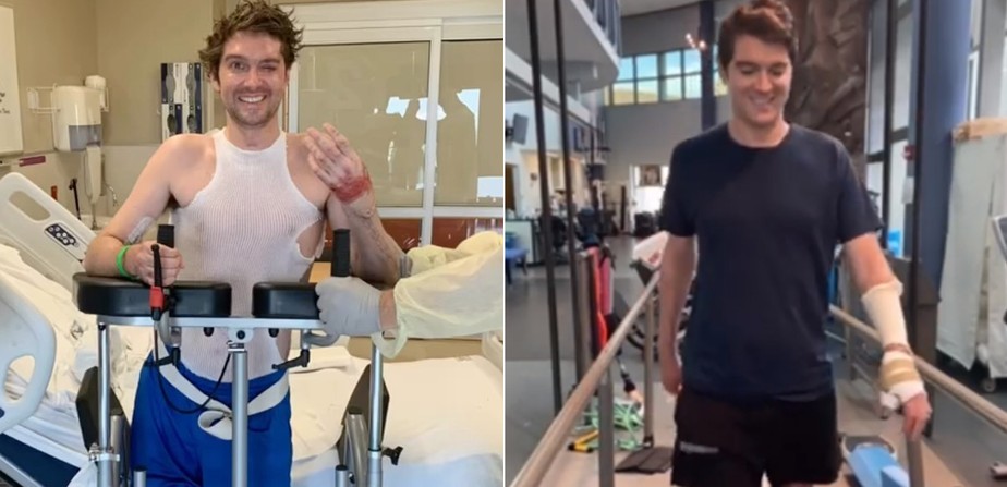 Jornalista que perdeu parte da perna na Ucrânia anda com ajuda de ...