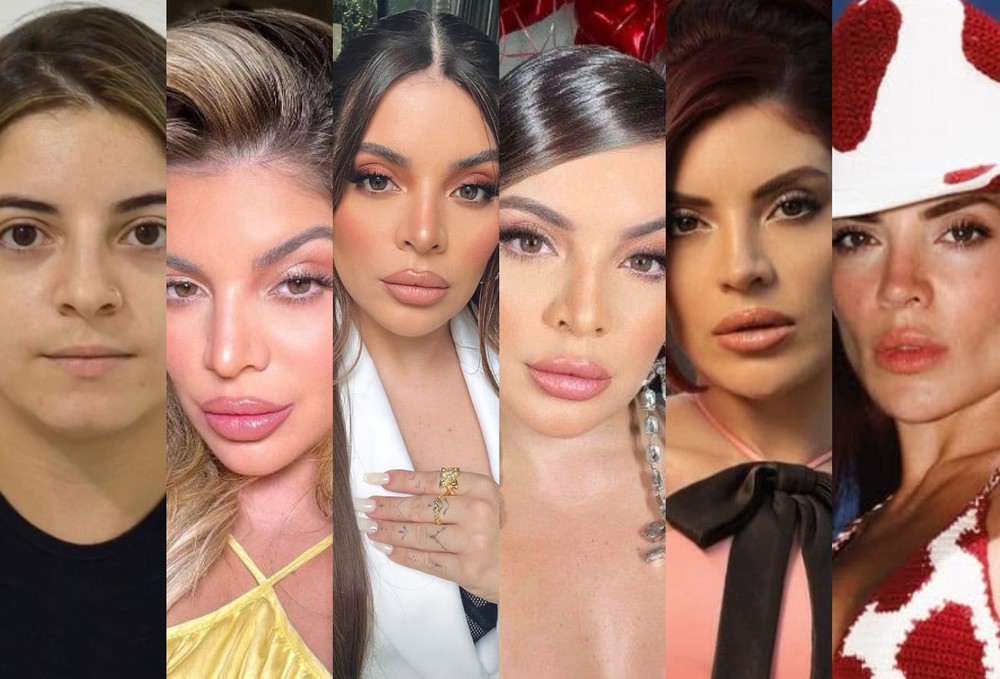 Gkay tem detalhe notado em seus dedos e explica: 'Assim desde nascença ...