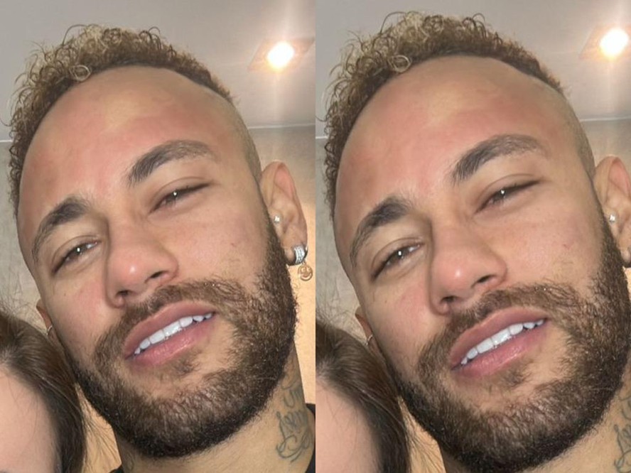 Neymar realiza procedimentos estéticos para cuidar da pele do rosto
