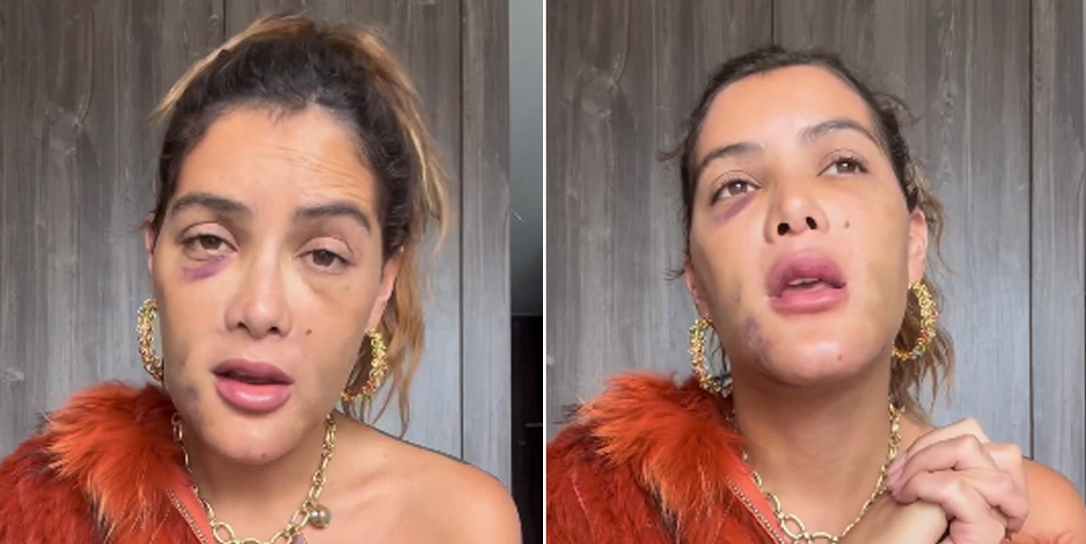 Atriz de 'Quanto Mais Vida, Melhor!' passa por cirurgia de emergência ...