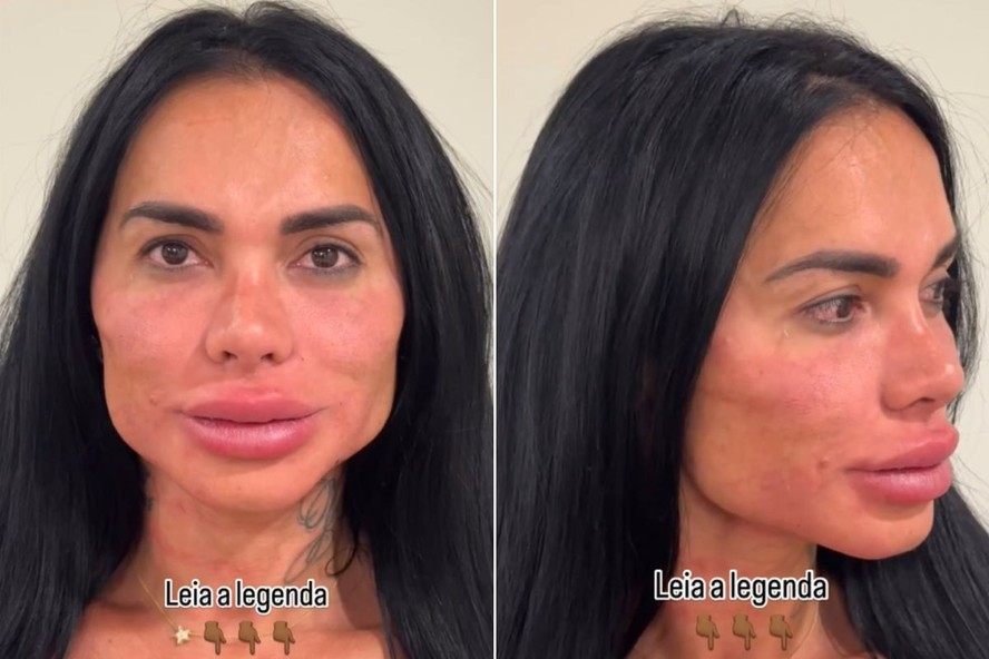 Kamila Simioni sobre procedimento estético: 'Sou a primeira a me ...