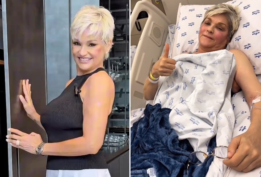 Andrea Nóbrega faz cirurgias após silicone encapsular: 'Vou virar uma ...