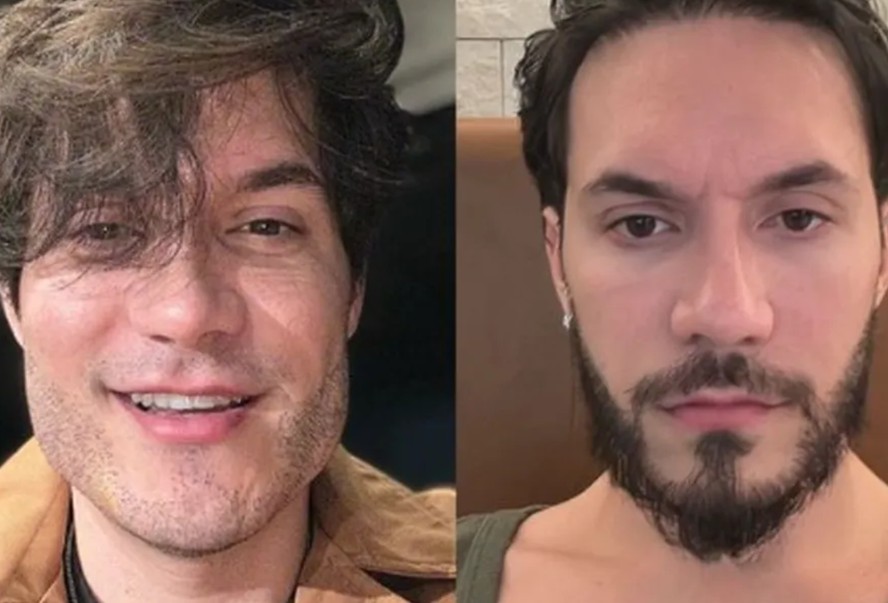 Ex-BBB Eliezer comenta arrependimento por procedimentos estéticos