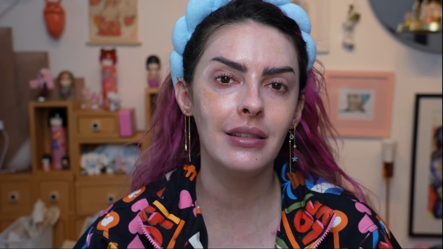 Karen Bachini revela diagnóstico de lipedema e faz desabafo; vídeo