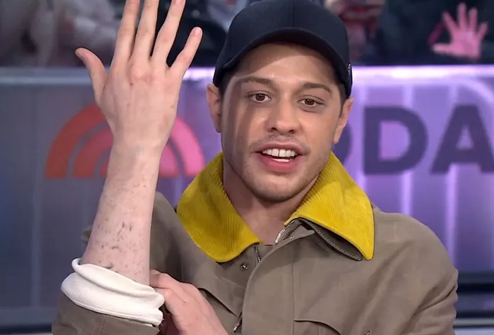 Pete Davidson, ex de Kim Kardashian, gasta R$ 1,1 milhão para remover tatuagens do corpo; veja ...