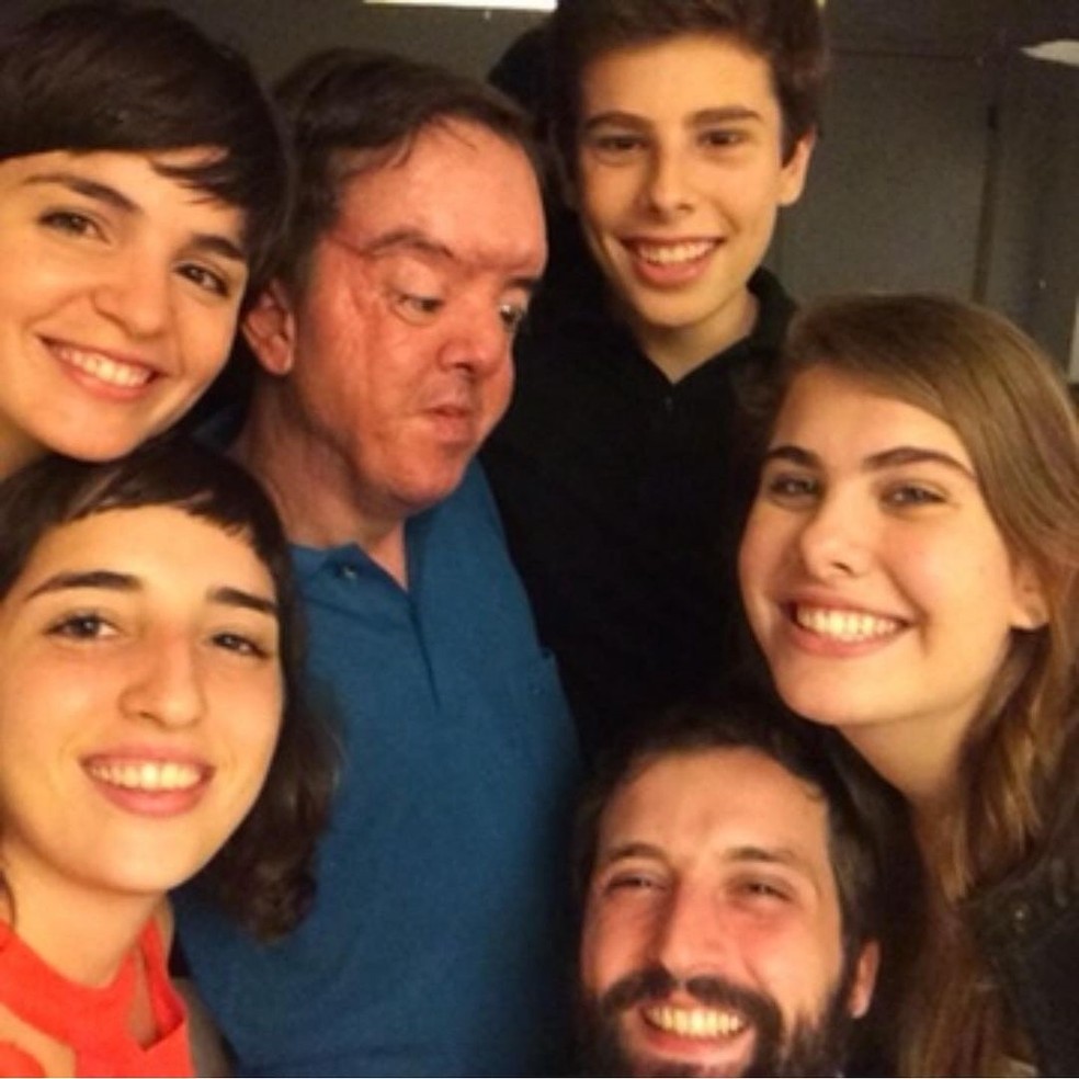 Gregorio Duvivier homenageia irmão nascido com síndrome de Apert: 'A ...