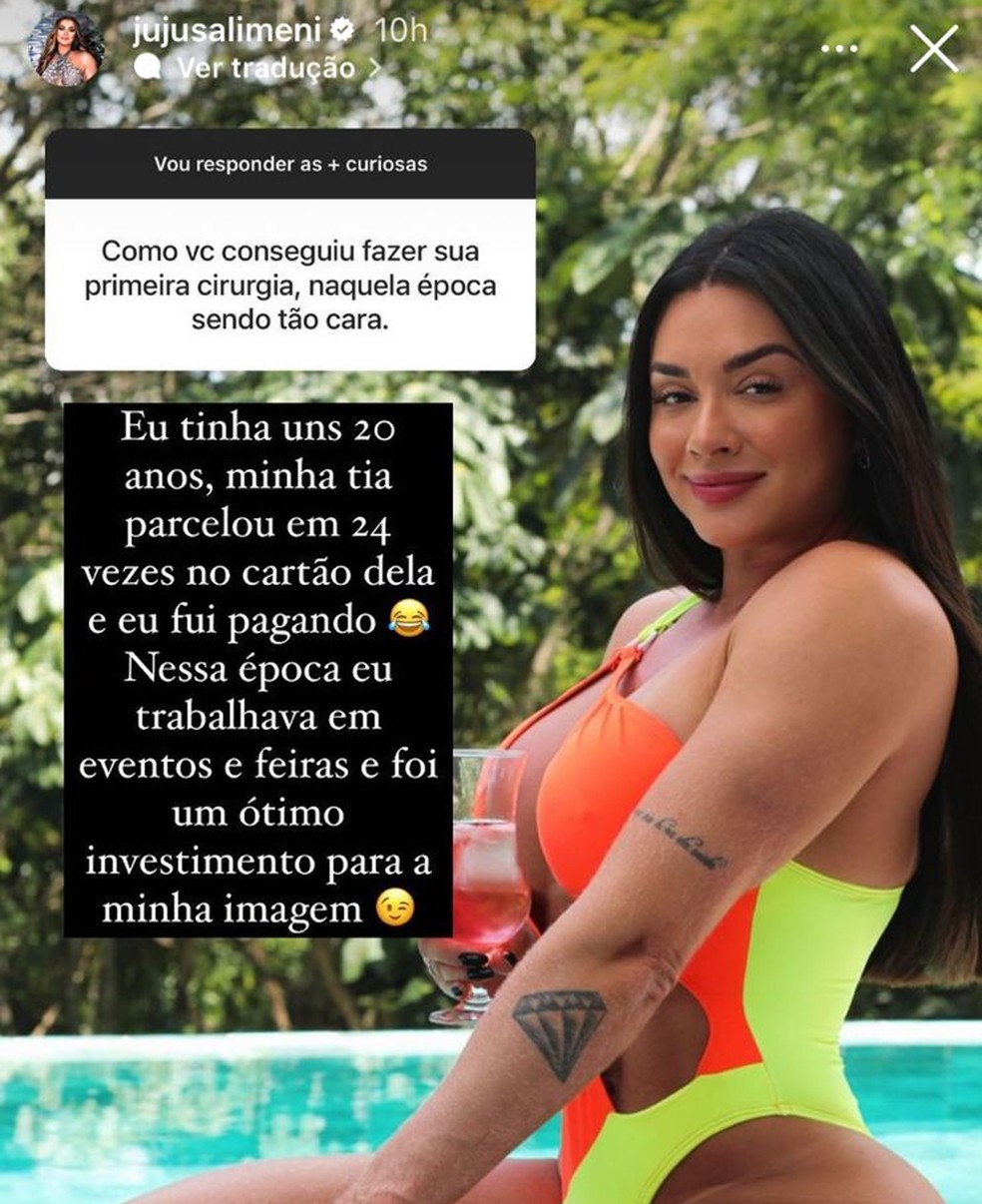 Juju Salimeni Diz Que Parcelou Primeira Cirurgia Plástica Em 24 Vezes