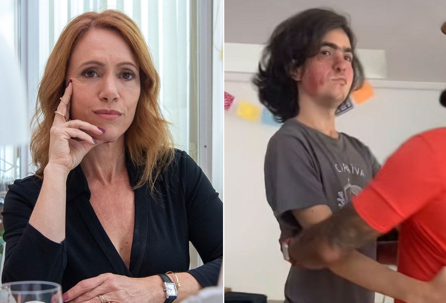 Bel Kutner celebra os 19 anos do filho, que tem esclerose tuberosa ...