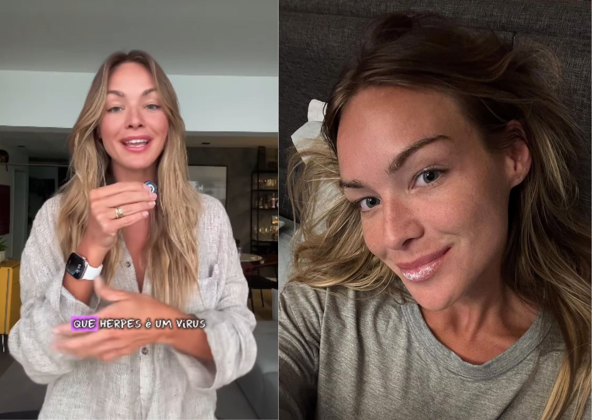 Bárbara Heck sobre herpes: 'Não é legal ter pereba na boca, e pior ...