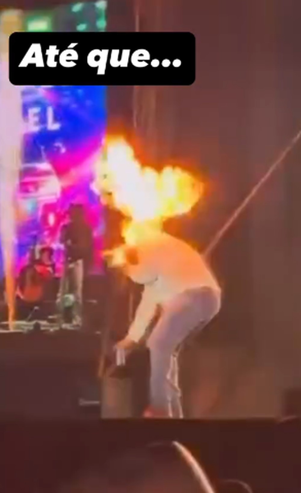 Vídeo: Sertanejo Léo mostra como ficou seu rosto após ser queimado em show