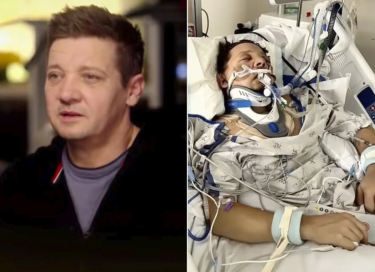 Jeremy Renner diz ter visto 'seu olho esquerdo com seu olho direito' em ...