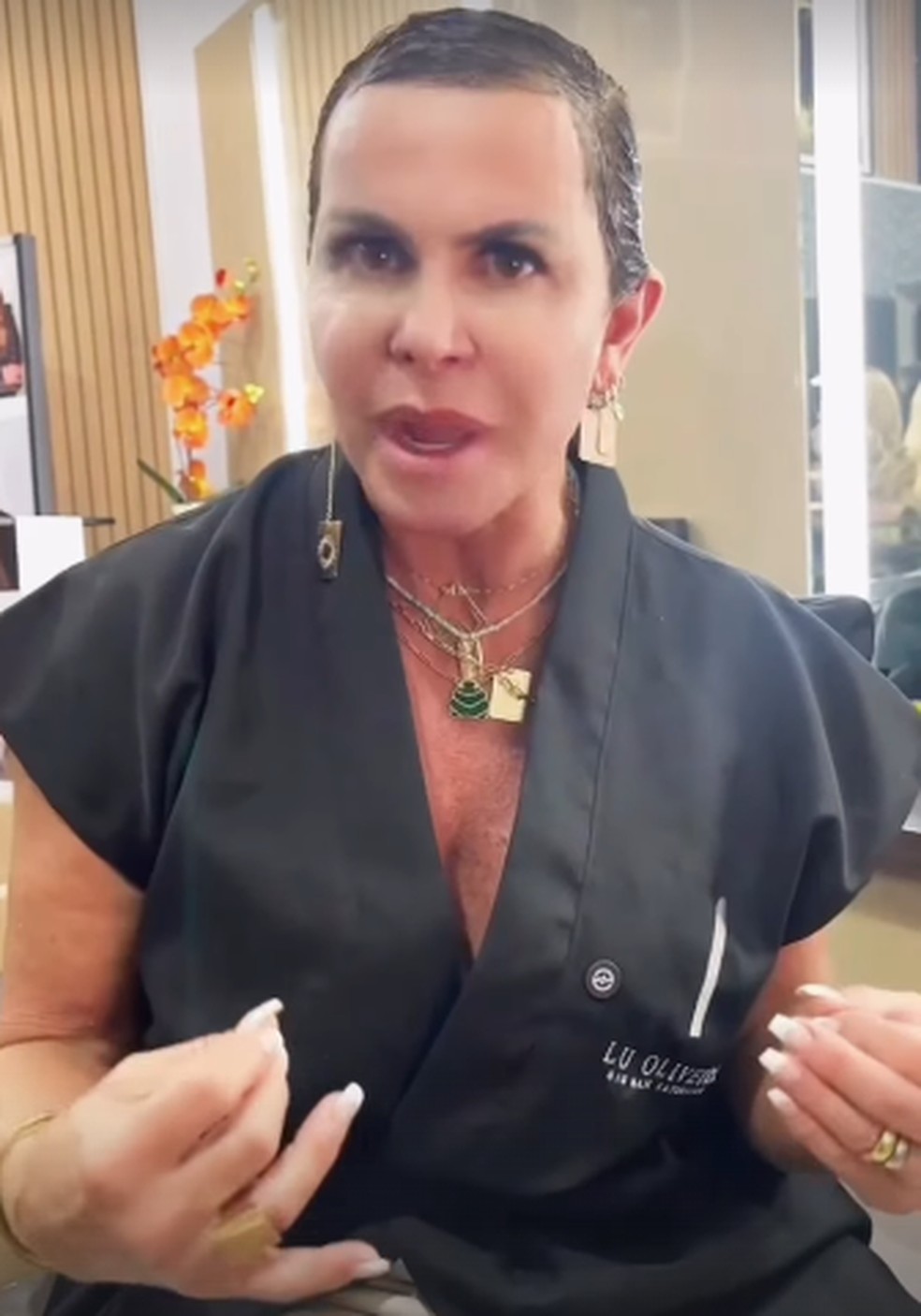 Com alopecia, Gretchen aparece sem mega hair: 'Faço questão que vejam a ...