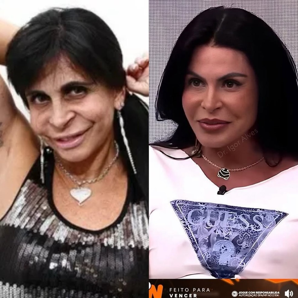 Responsável por harmonização de Gretchen a elogia por paciência para esperar resultado