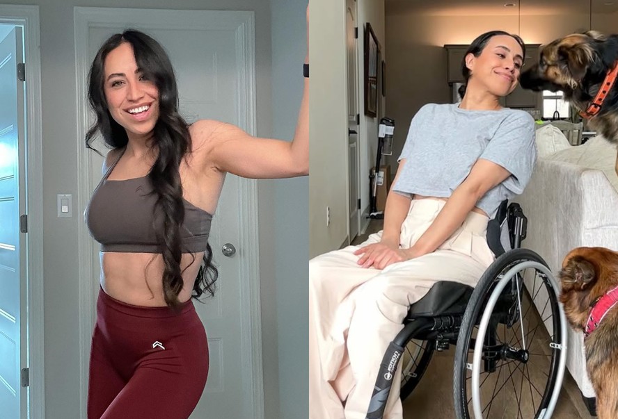 Influencer fitness fica com corpo paralisado após ser picada por carrapato