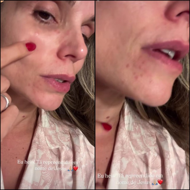 Flávia Viana tem reação alérgica e chora ao se arrumar para casamento ...