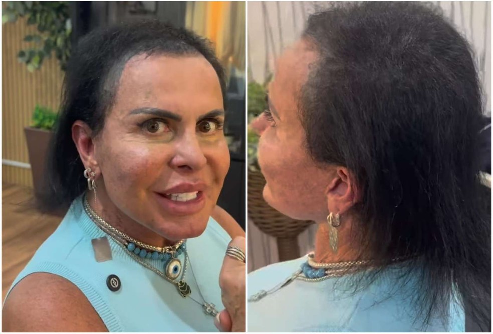 Gretchen mostra antes e depois de manutenção capilar: 'Este cabelo tem ...