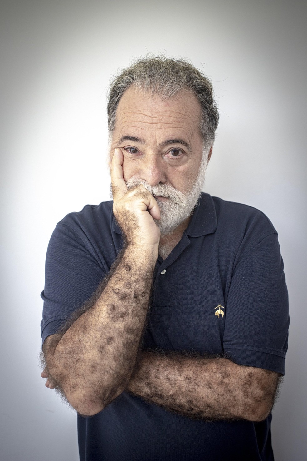 Tony Ramos passa por cirurgia cerebral após sangramento; entenda