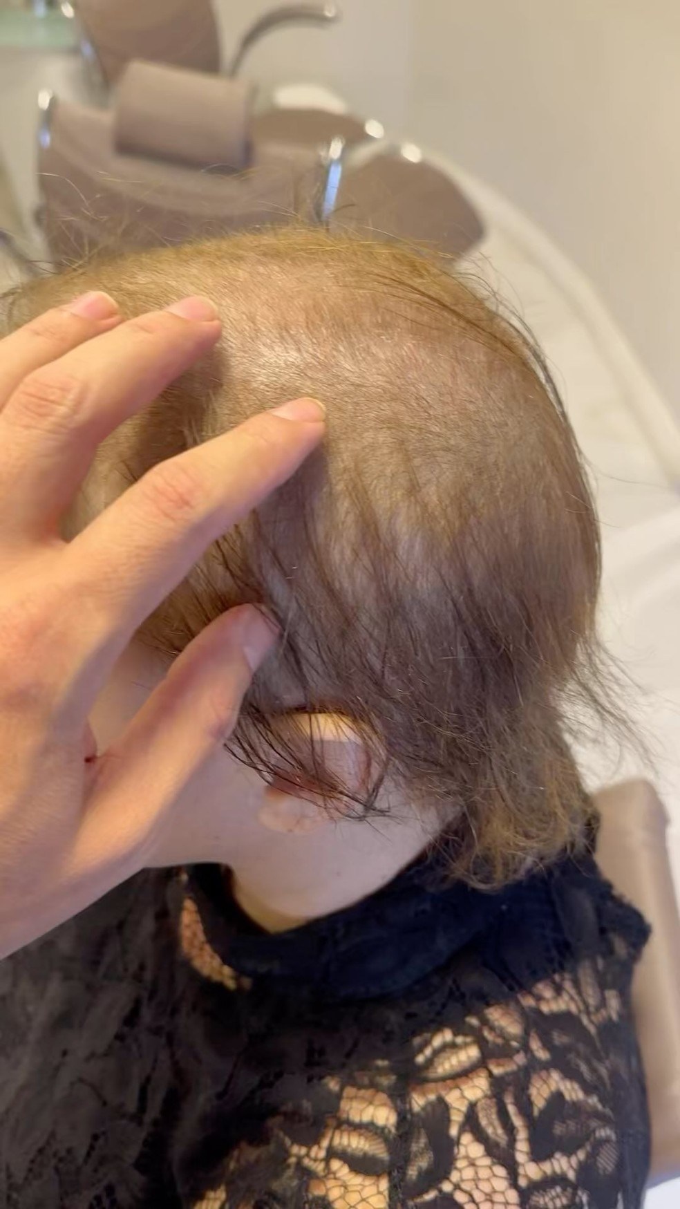 Simony mostra novo visual e queda de cabelos por causa de tratamento ...