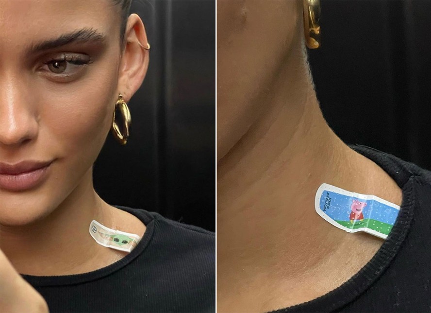 Laura Fernandez faz reflexão um mês após retirada de nódulo no pescoço