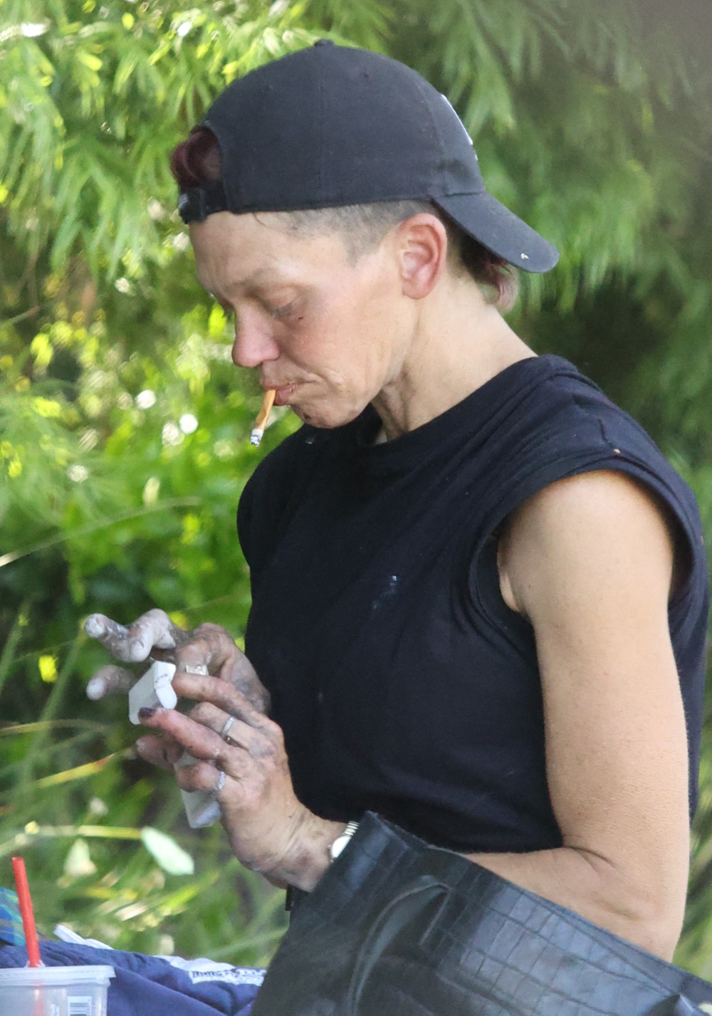 Em situação de rua, ex-modelo Loni Willison exibe dedos deformados ...