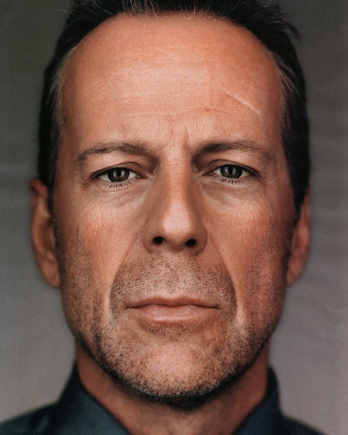 Saiba o que é a Demência Frontotemporal, doença de Bruce Willis