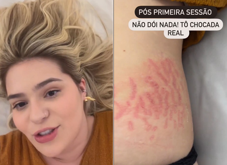 Viih Tube faz tratamento para estrias da gravidez de Lua Di Felice ...