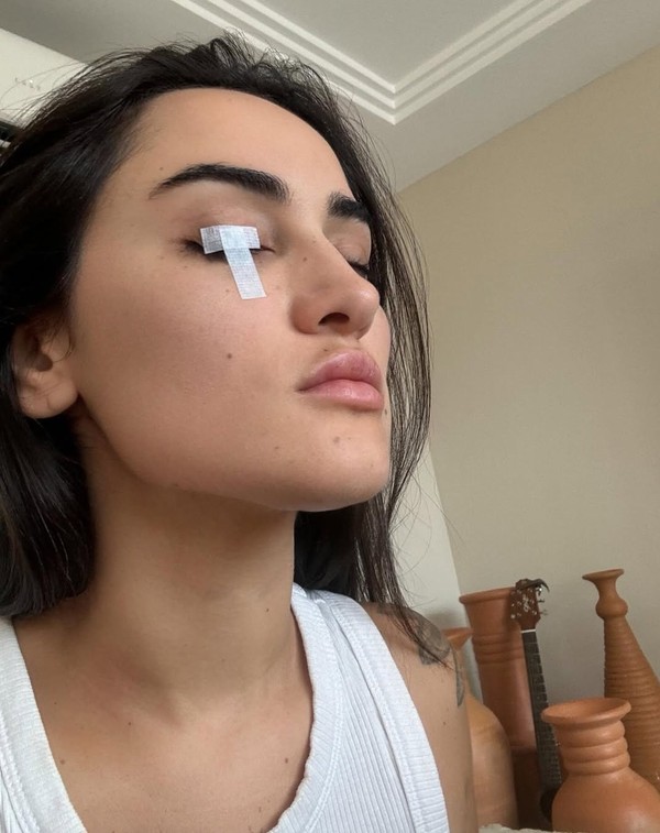 Gabi Melim fala de tratamento contra paralisia de Bell, e atualiza fãs ...