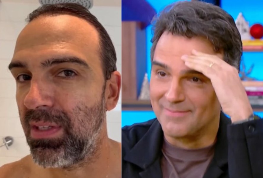 Tadeu Schmidt é forçado a revelar implante de cabelo no 'Mais Você ...