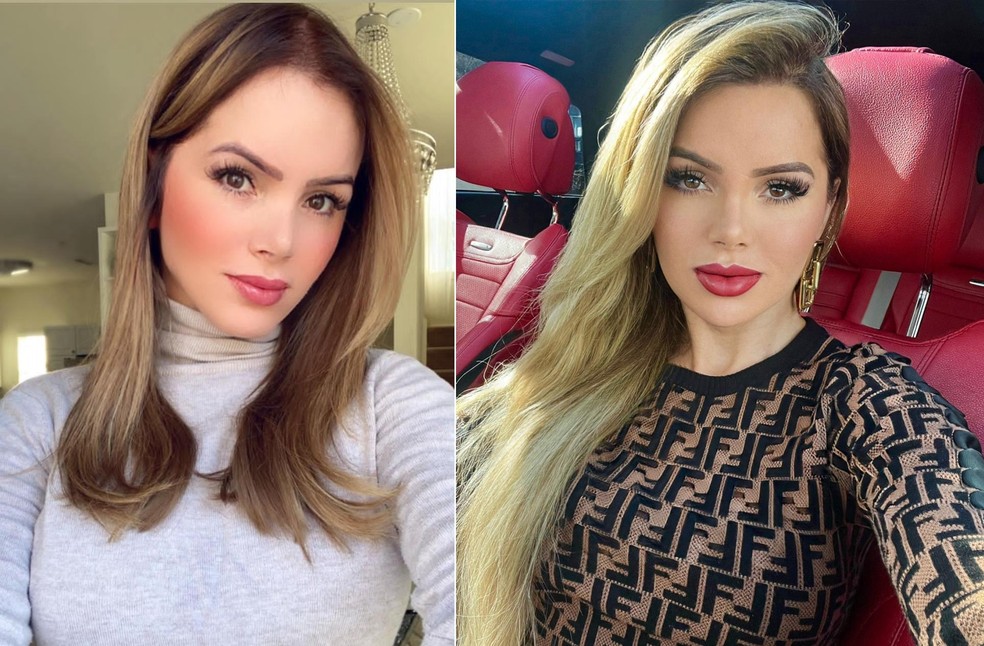 Thalita Zampirolli faz procedimento labial: 'Boquinha de Angelina Jolie'