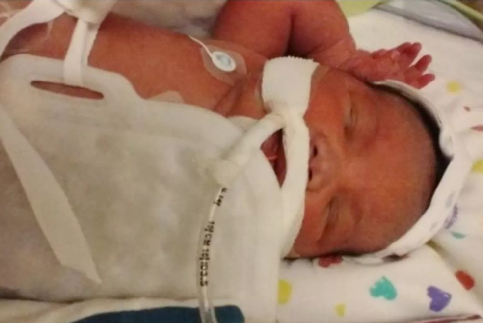 Modelo americana grávida de 8 meses é baleada e dá a luz antes de morrer