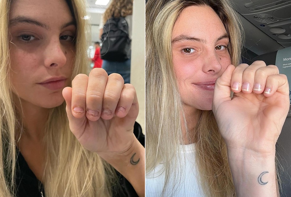 Lele Pons para de roer as unhas depois de 25 anos; veja