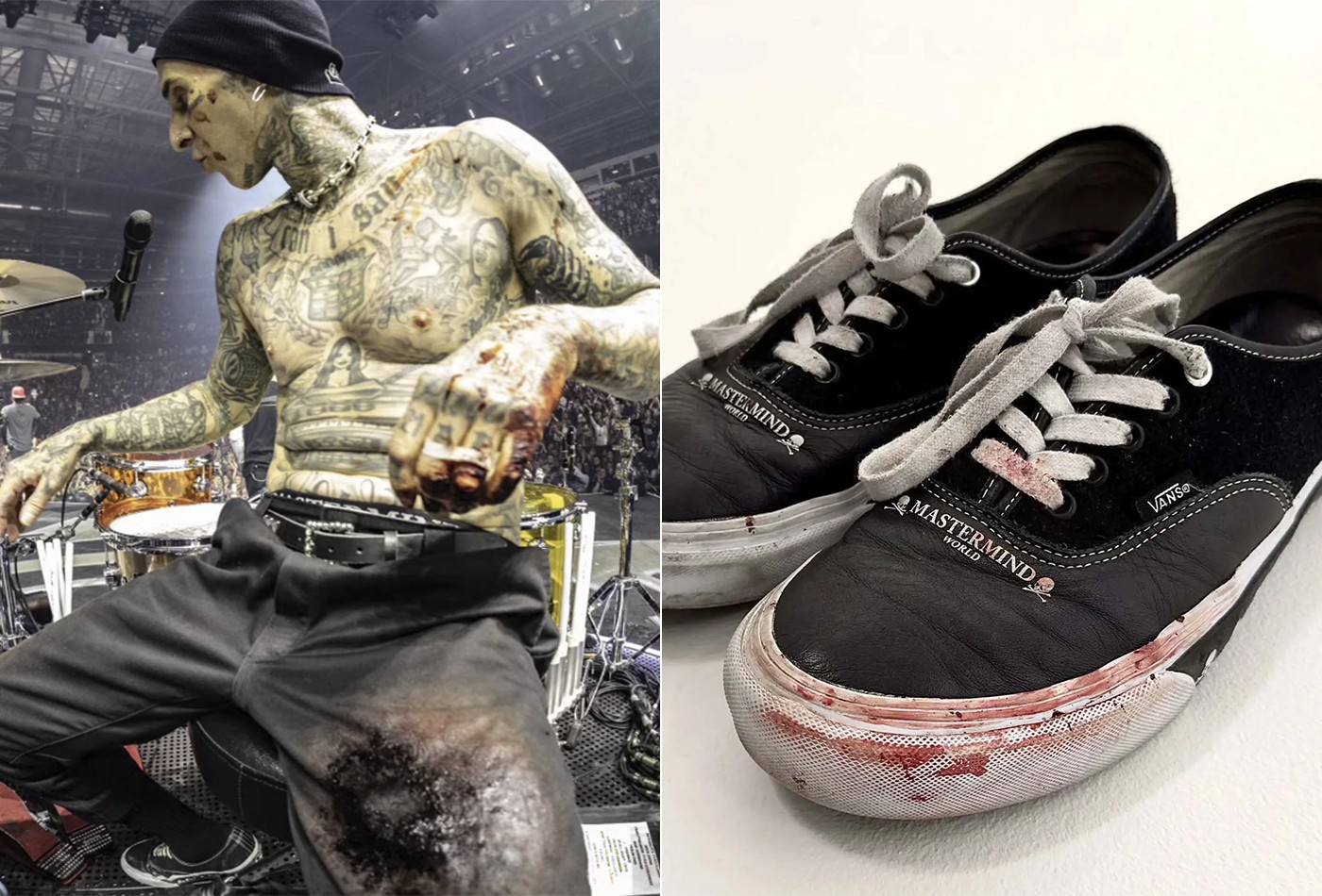 Travis Barker vende look ensanguentado por R$ 49 mil