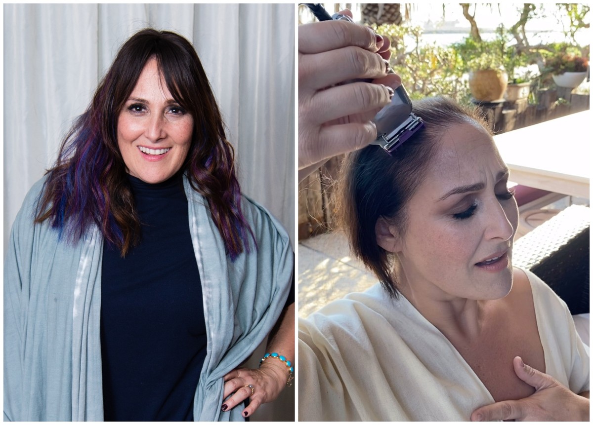 Com alopecia, atriz de 'Hairspray' emociona ao mostrar vídeo raspando ...
