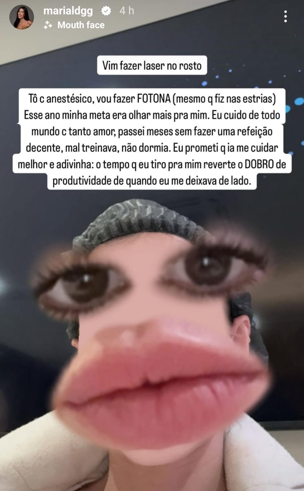 Maria Lina faz laser, retoca boca e trata alopecia em clínica: 'Sou ...