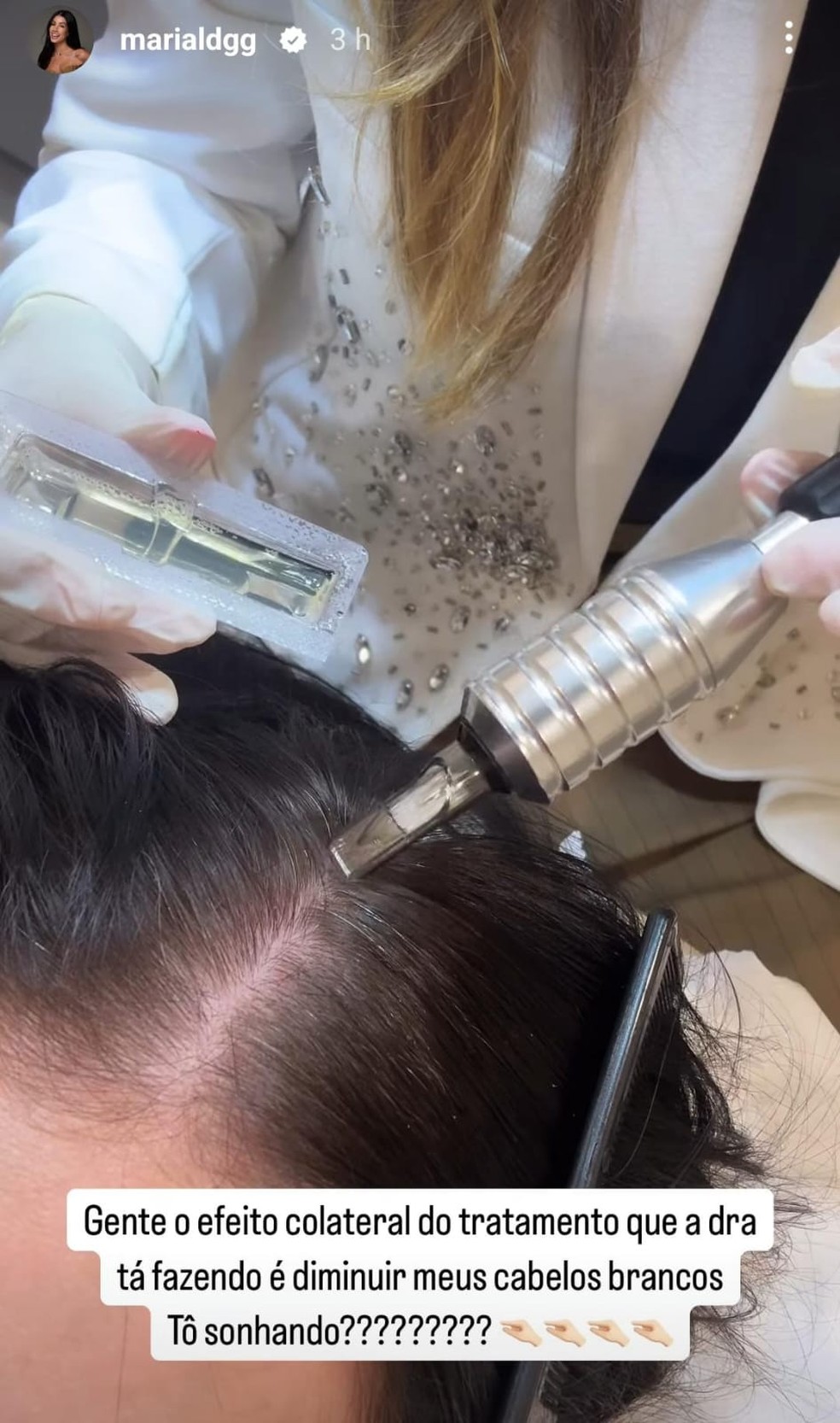 Maria Lina faz laser, retoca boca e trata alopecia em clínica: 'Sou ...