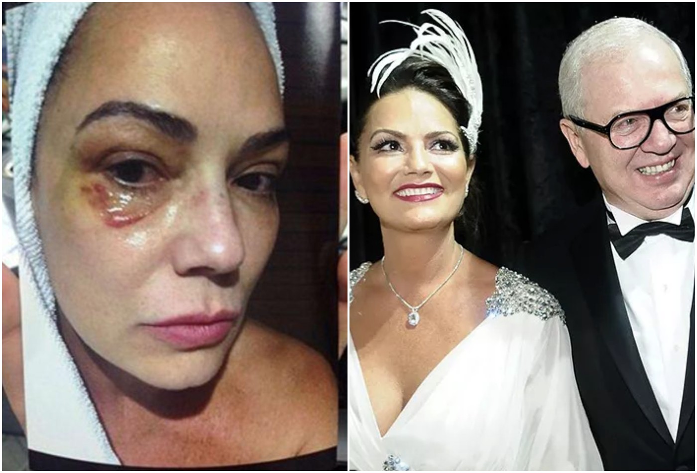 Luiza Brunet pede indenização de R$1 milhão por agressão de ex-marido