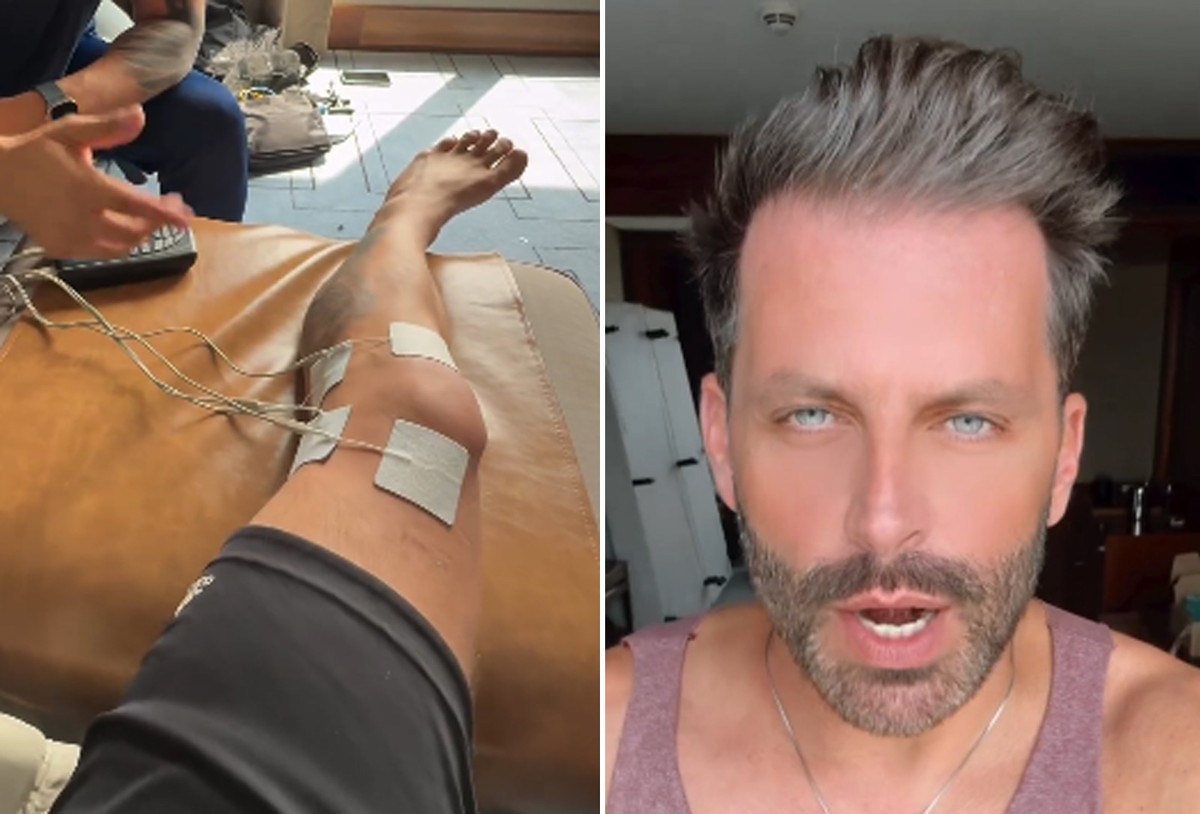 No 'Dança dos Famosos', Henri Castelli mostra tratamento em perna ...